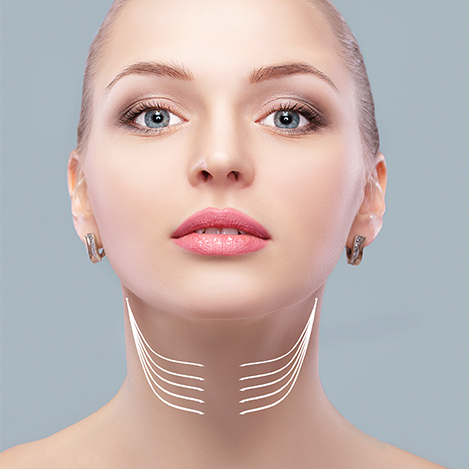 Neck Lift – Clinica Ramita